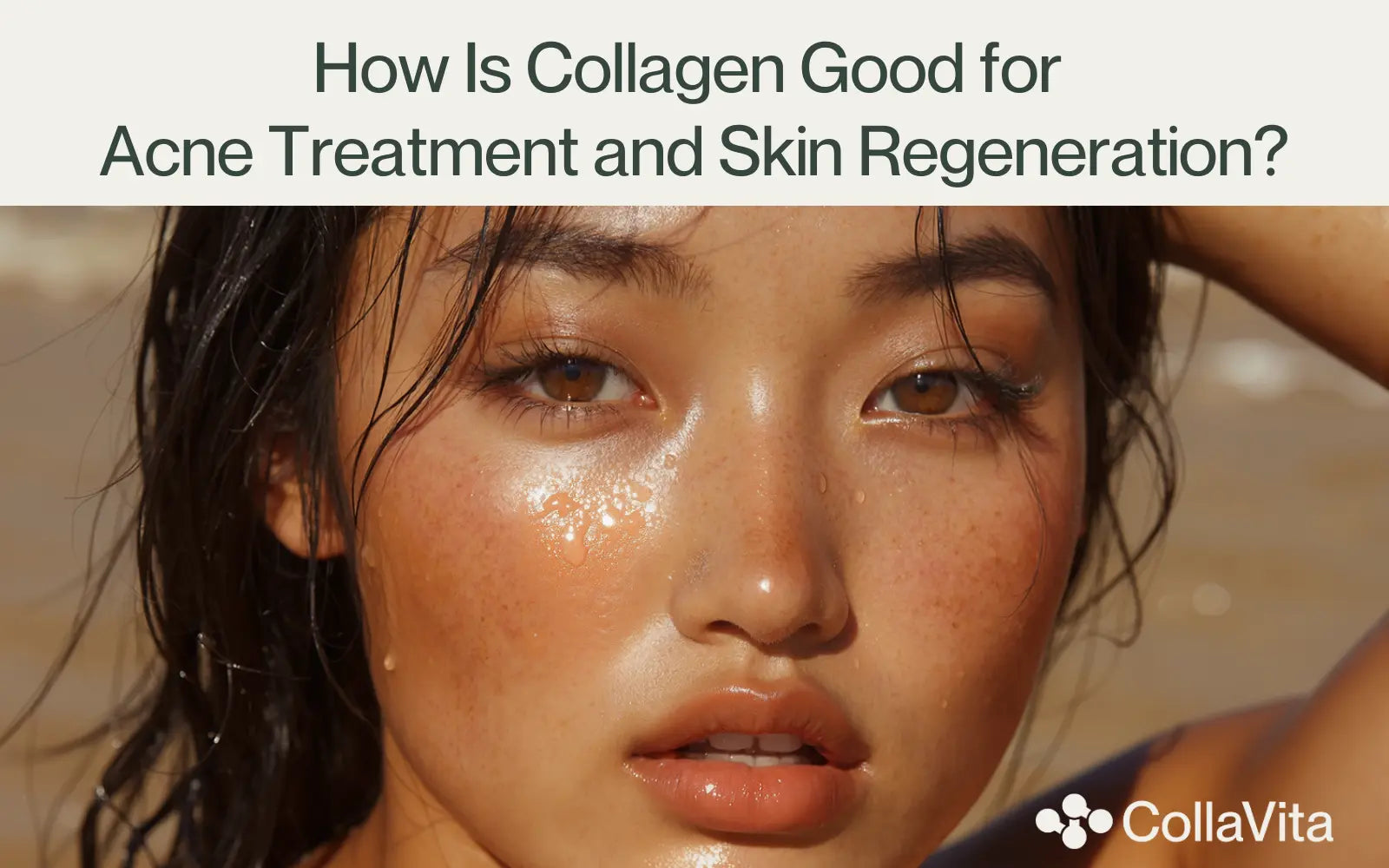How Is Collagen Good for Acne Treatment and Skin Regeneration?